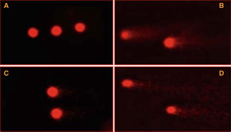 1 Typical Results From A Comet Assay A Basal Dna Damage From