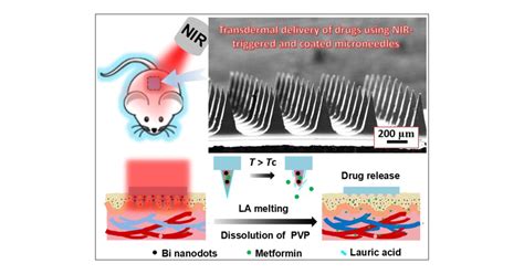 Fabrication Of Dissolving Microneedles With Thermal Responsive Coating