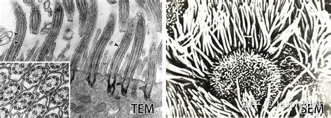 生物超微结构观察简介 知乎