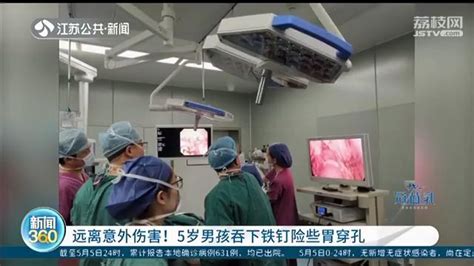 5岁男孩误吞下铁钉 一个月后被胃酸腐蚀变粉碎