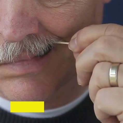 Dr Silvas Dental Clinic Mangalore On Linkedin 🦷🚫 Stop Using