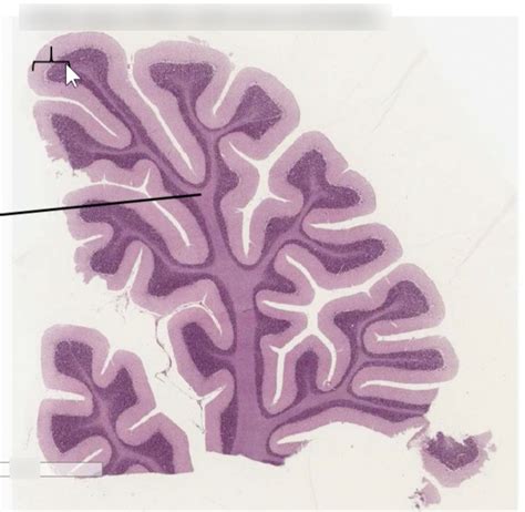 Label Cerebellum Aperio Diagram Quizlet