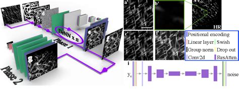 Figure 1 From Self Similarity Based Super Resolution Of Photoacoustic Angiography From Hand