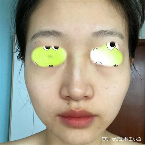 早C晚A真的适合你吗醒醒吧公式化早C晚A是你抗老路上的烟雾弹 90 的人根本不会注意这一步抗老毫无起色 知乎