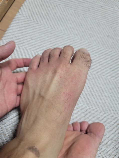 발등 간지러움 지식in