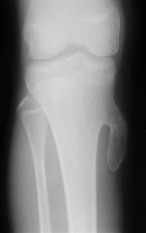 Ucsd Musculoskeletal Radiology