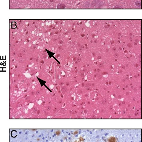 Neuropathological Analysis Of Transgenic Mouse Brain A Cerebral Download Scientific Diagram