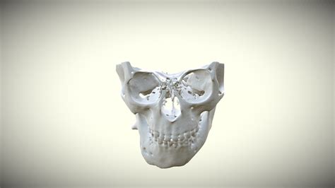 3dp00001mandibulartumor 3d Model By 3dphsjd Ed7f08f Sketchfab