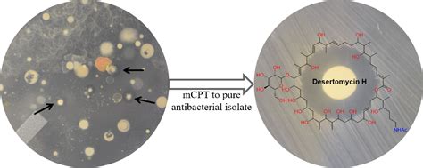 Enterococcus Faecalis Streak Plate