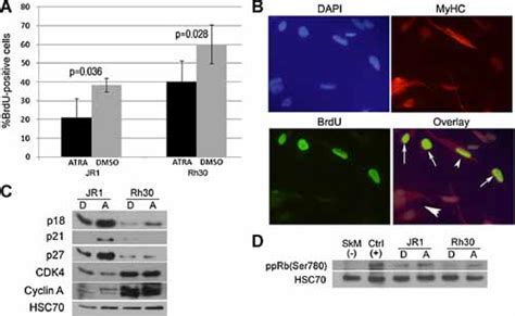 Atra Induced Differentiation Does Not Prevent Rms Cellular