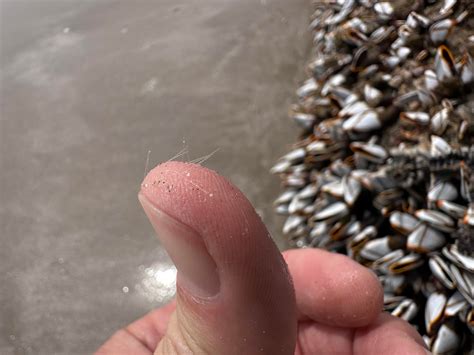 Harte Research Institute This Is What My Hand Looked Like After