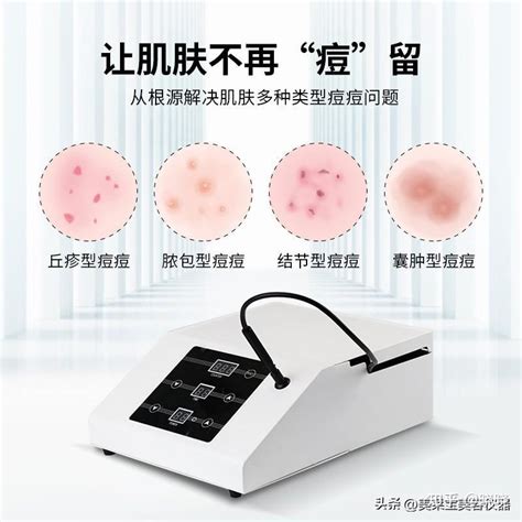 祛痘仪的技术原理？ 知乎