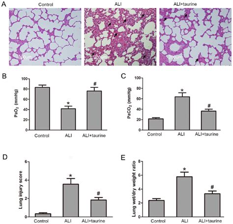 Taurine Suppressed Lung Injury In Clp Induced Septic Ali Model Rats