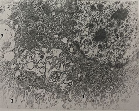 Electron Micrographs Quiz