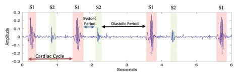 A New Method For Heart Disease Detection Long Short Term Feature Extraction From Heart Sound Data