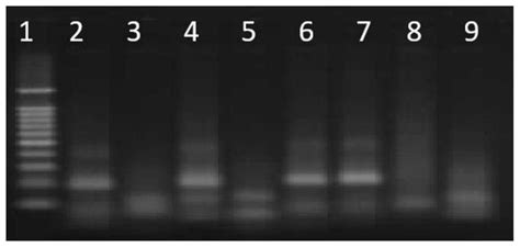 Rpa Detection Primer Probe Combination Kit And Detection Method Of Transgenic Rice Eb7001s 6
