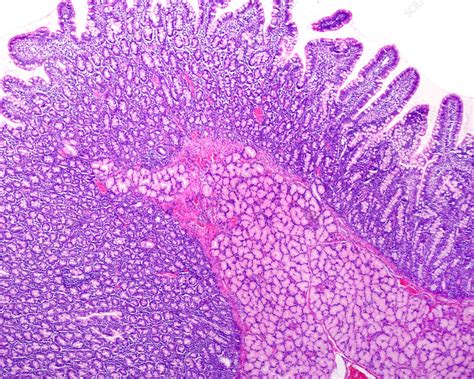 Brunner Glands In Duodenum Light Micrograph Stock Image C059 3792 Science Photo Library