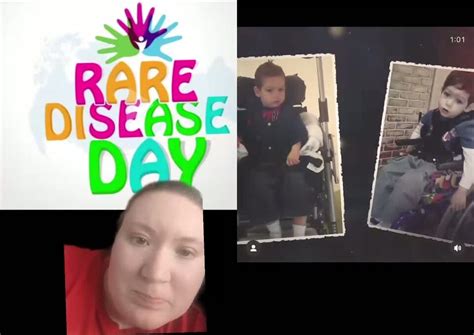 Rare Disease Awareness Month February 2025 Month February 2025