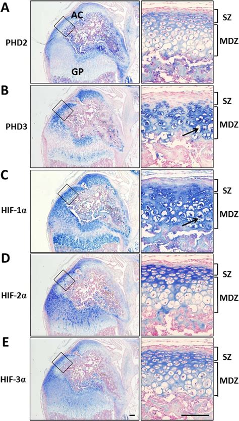 Expression Patterns Of Phds And Hifs In The Articular Cartilage