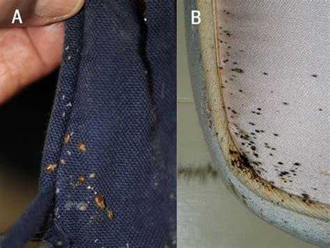 Bed Bug Infestation The Bmj