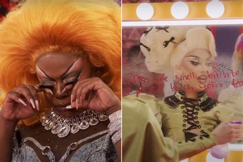 Drag Race” Star Onya Nurve Tearfully Reveals Dental Condition After