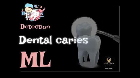 ai powered dental caries detection system machinelearning project