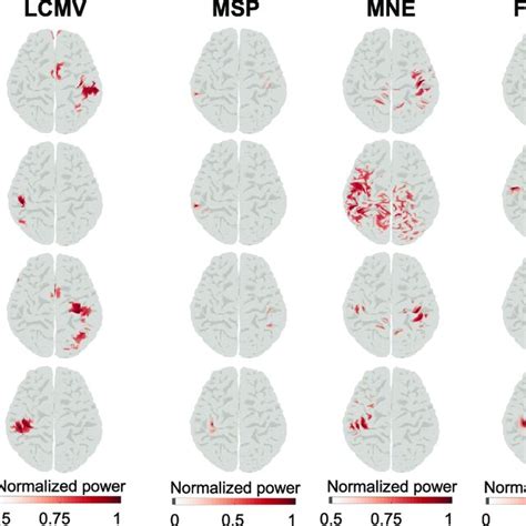 Optically Pumped Magnetometer Magnetoencephalography Opm Meg System