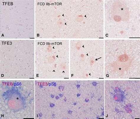 Mtorc1 Restricts Tfe3 Activity By Auto Regulating Its Presence On