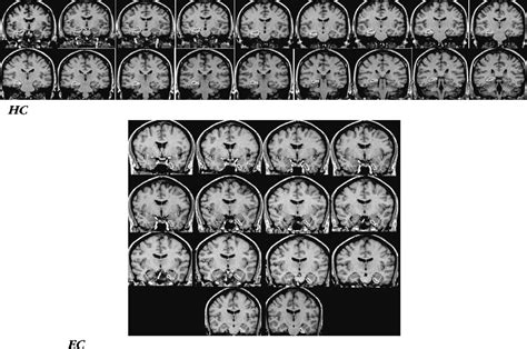 Structure Of Entorhinal Cortex Semantic Scholar