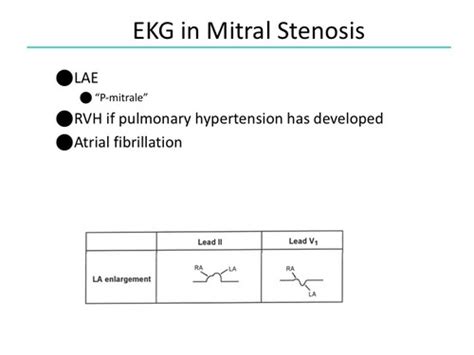 Mitral Valve Disease Flashcards Quizlet