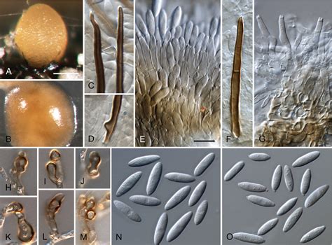 Table 3 From The Colletotrichum Acutatum Species Complex Semantic Scholar
