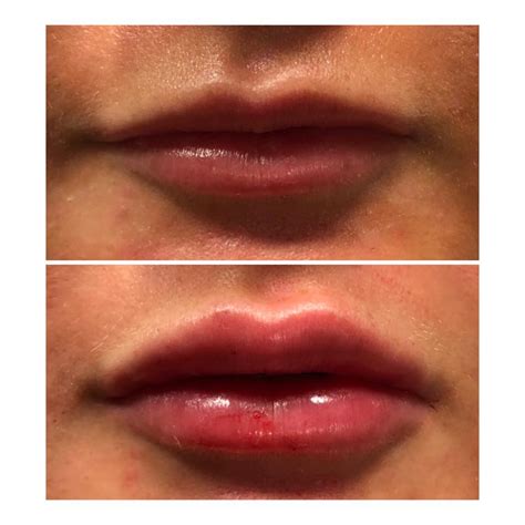 Gallery Enhanced Facial Aesthetics