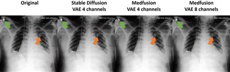 Reconstruction Quality Comparison Both The “out Of The Box” Vae Of The