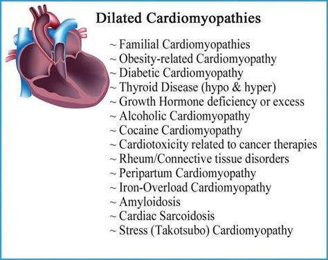 Ischemic Cardiomyopathy Treatment