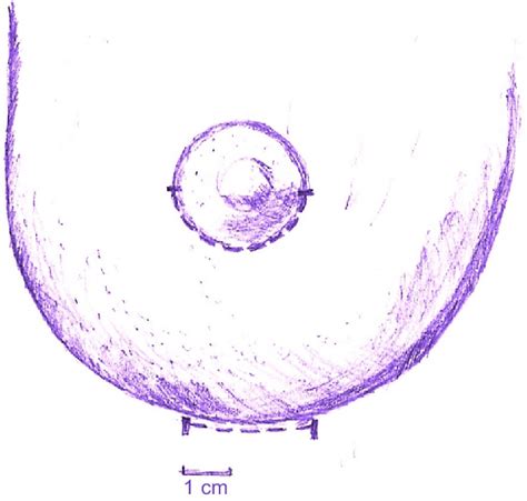 Visual Comparison Of The Difference Between A Straight Incision And A Download Scientific