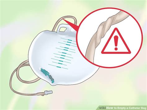 How To Empty A Catheter Bag 10 Steps With Pictures Wikihow
