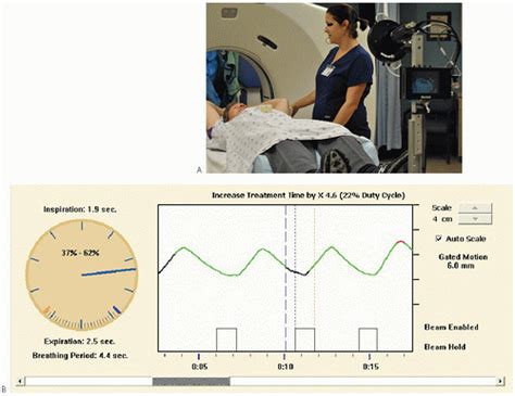 Stereotactic Body Radiation Therapy Radiology Key