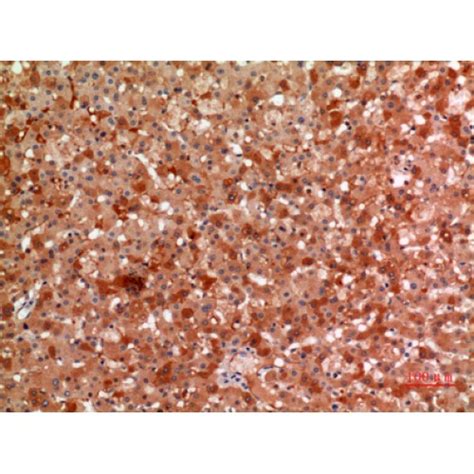 Anti A2m Alpha 2 Macroglobulin Antibody Rabbit Anti Human Lsbio