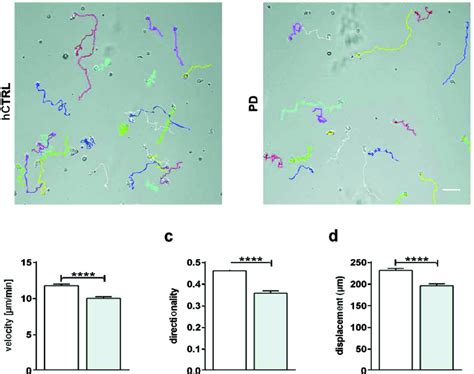 Primary Cd4 T Cells Derived From Pd Patients Are Slower And Less