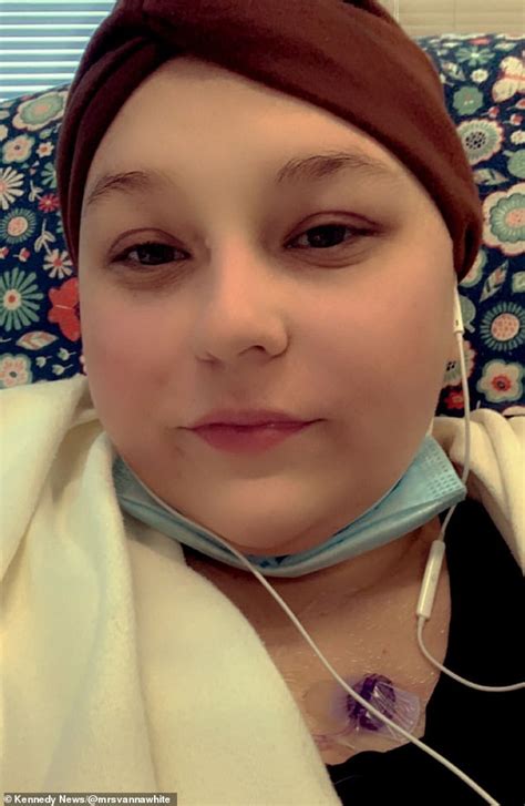 I Went For Breast Reduction Surgery To Downsize My Size H Boobs And