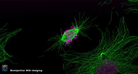 2018 Conference On Quantitative Bioimaging Qbi France Bioimaging
