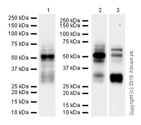 Anti Runx1 Aml1 Antibody Epr23044 100 Ab240639 Abcam