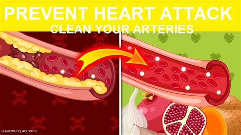 7 Super Foods That Unclog Arteries Naturally And Prevent Heart Attack