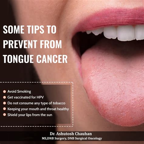Hpv Mouth