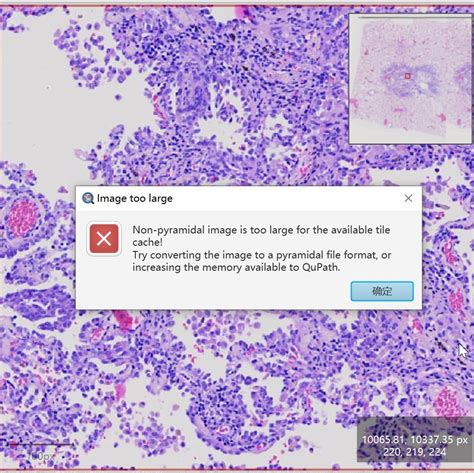 Qupath Cannot Open Too Large Tiff Format Picture Usage And Issues Imagesc Forum