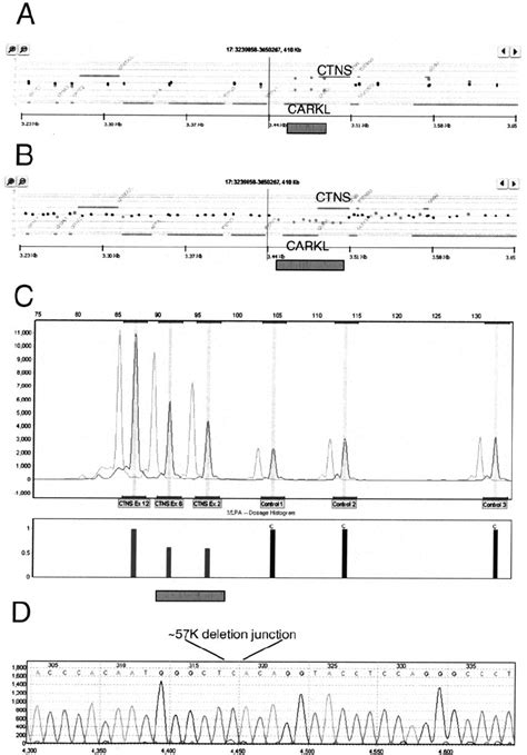 Oligonucleotide Array Cgh Detection Of A Heterozygous Genomic Deletion