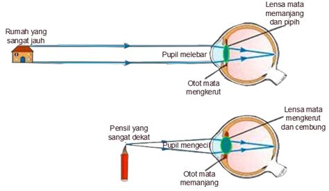 Bagian Bagian Dan Kelainan Pada Mata Bunga Kertas