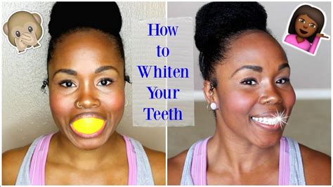 How To Whiten Teeth At Home Fast Best Whitening Kit And Home Remedies Youtube