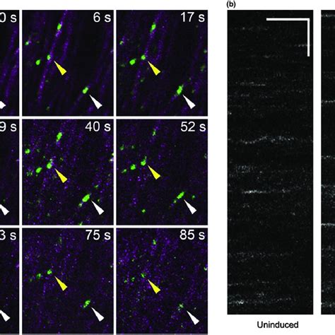 Exocyst Is Involved In The Correct Targeting Of Secondary Cell Wall