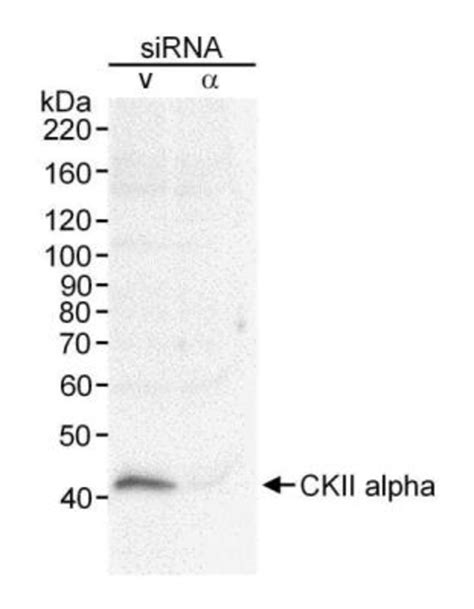 Casein Kinase 2 Alpha Antibody 01mg Unlabeledantibodies Polyclonal